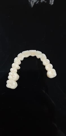 Cirkon keramička krunica - Dentalni laboratorij Ivana Rožić | mojkvart.hr