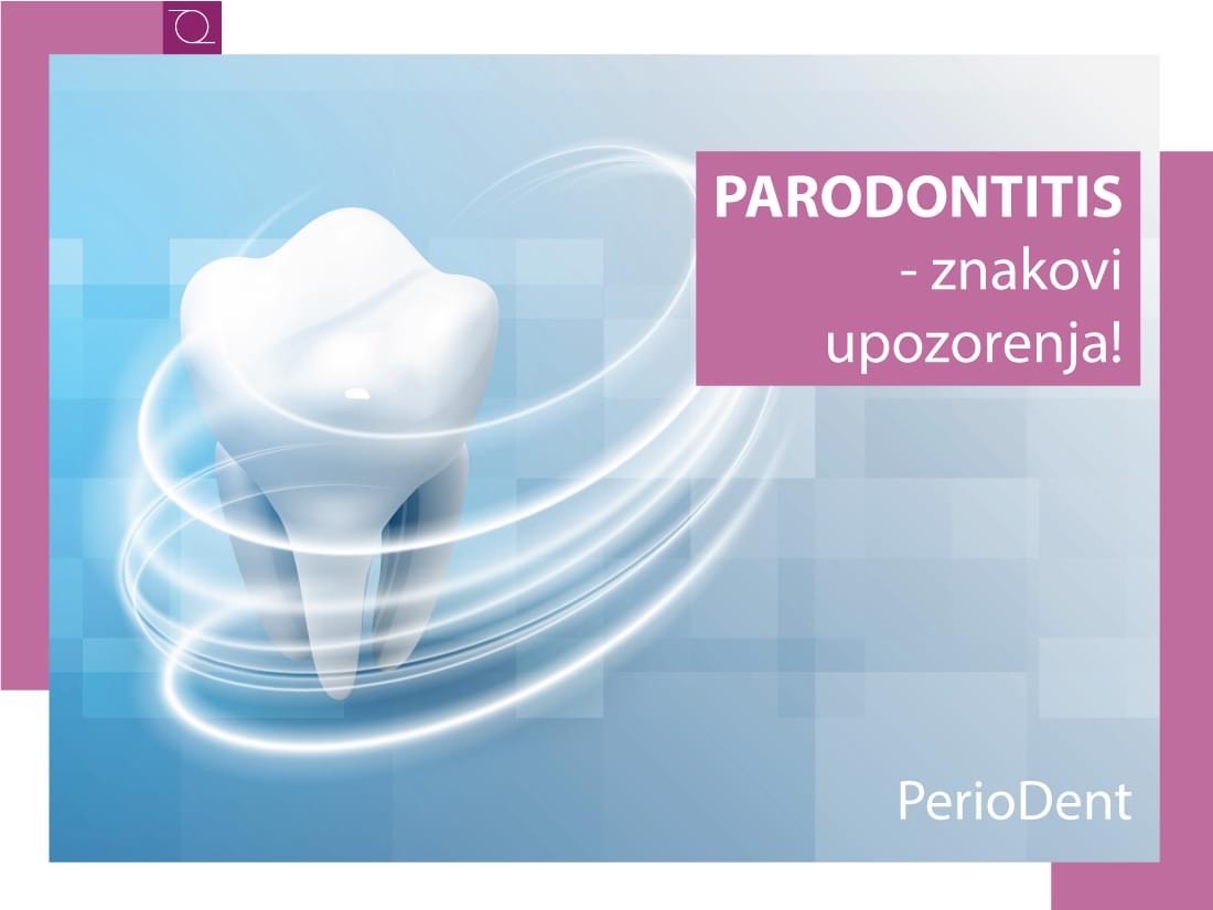 Znate li prepoznati simptome parodontitisa? - CENTAR ZA PARODONTOLOGIJU ...